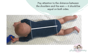 Asymmetry in Infants — 3 Things Worth Noting - Physiomommy