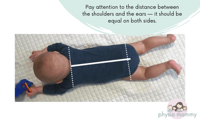 Asymmetry in Infants — 3 Things Worth Noting - Physiomommy